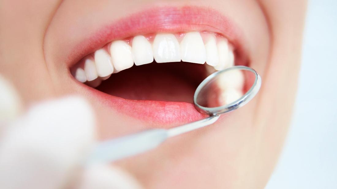 Causes and Treatment of Halitosis | West Allis WI Dentist